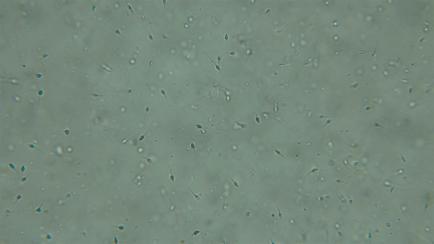 human sperm under microscope spermatozoa consists Stock Footage Video ...