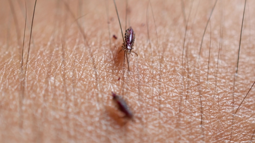 Bird skin microscope Stock Video Footage - 4K and HD Video Clips ...