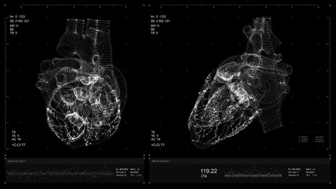 Heart Scan Screen Animation Device Scans Stock Footage Video (100% ...