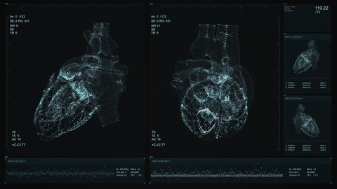 Brain Scan Screen Animation Device Scans Stock Footage Video (100% ...