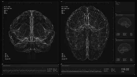 Brain Scan Visualization Footage Device Scans Stock Footage Video (100% ...