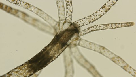 Young Actiniaria Under Microscope Class Anthozoa Stock Footage Video ...