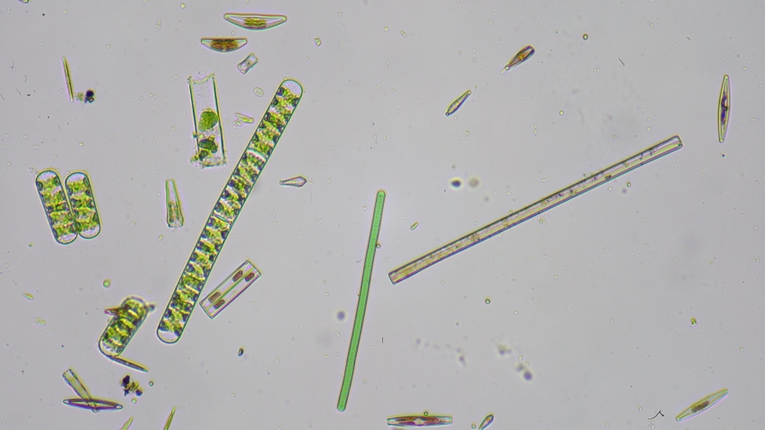 cyanobacteria oscillatoria moving freshwater pond sample Stock Footage ...