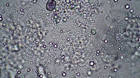 Lactic Acid Bacilli Leaven Milk Under Stock Footage Video (100% Royalty ...