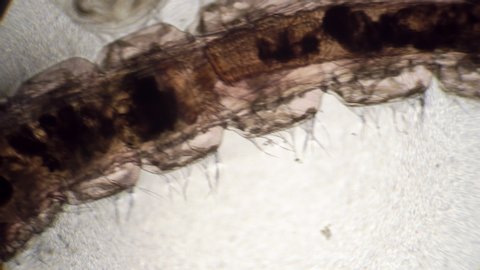 Larva Mosquito Moth Crustacean Daphnia Swim Stock Footage Video (100% ...