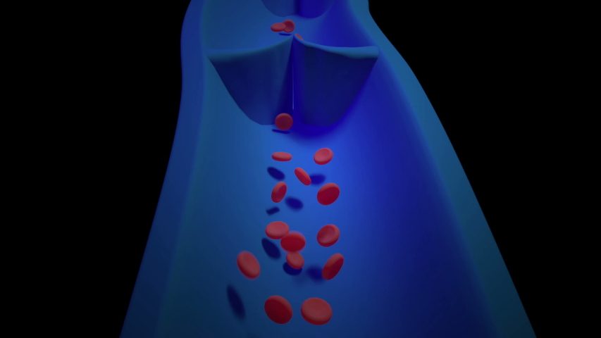 Varicose Legs Stock Video Footage - 4K and HD Video Clips | Shutterstock