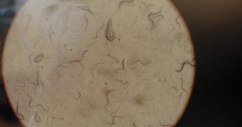 Nematode Stock Video Footage - 4K and HD Video Clips | Shutterstock