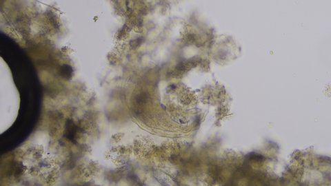 Ciliate Microscopic Organism Under Microscope Stock Footage Video (100% ...