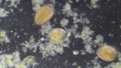 Water Flea Cladocera Under Microscope Dark Stock Footage Video (100% ...