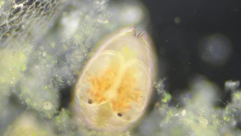 Water Flea Cladocera Under Microscope Dark Stock Footage Video (100% ...