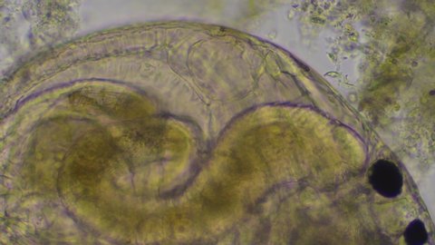 Water Flea Cladocera Under Microscope Stock Footage Video (100% Royalty ...