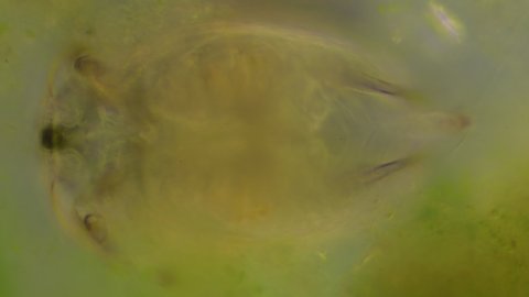 Water Flea Cladocera Under Microscope Stock Footage Video (100% Royalty ...