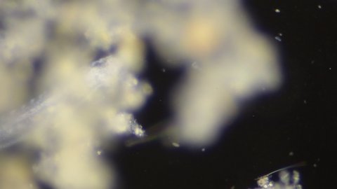 Ciliate Microscopic Organism Under Microscope Stock Footage Video (100% ...