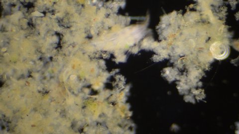 Copepod Cyclops Sp Under Microscope Stock Footage Video (100% Royalty ...