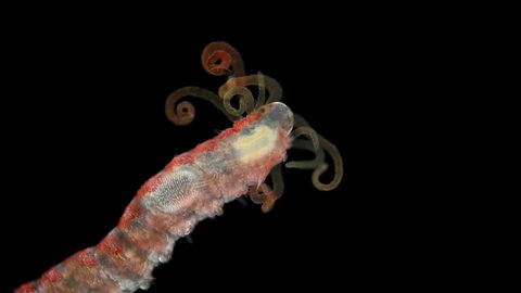 Worm Proceraea Sp Under Microscope Syllidae Stock Footage Video (100% ...