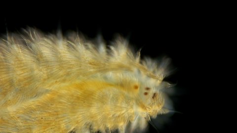 Worm Chrysopetalidae Family Under Microscope Class Stock Footage Video ...