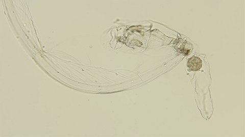 Under Microscope Plankton Zooplankton Appendicularia Belong Stock ...