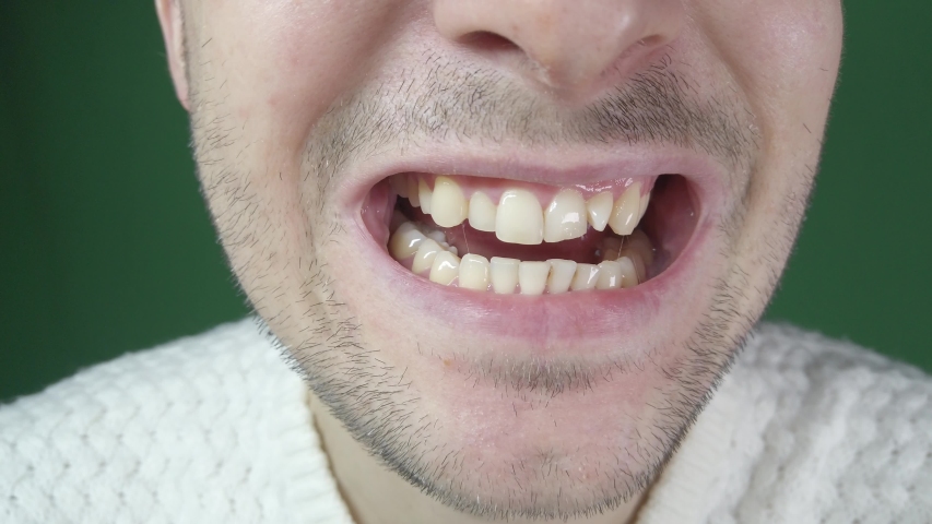 close-up men's mouth different variants facial Stock Footage Video (100 ...