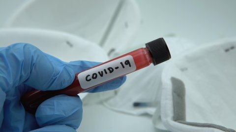 Blood Sample Tube Anti Tpo Antithyroid Stock Photo 1915703095 ...