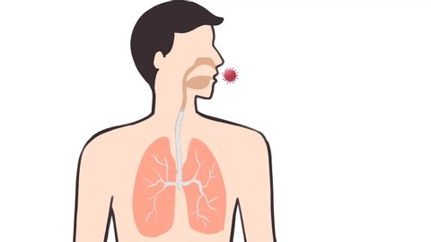 Polycythemia Vera Pv Blood Clots Cancer Stock Vector (Royalty Free ...