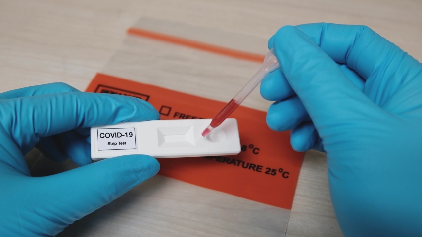rapid covid-19 strip test laboratory Stock Footage Video (100% Royalty ...