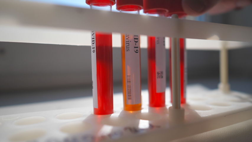 sliding shot Test tube with blood sample for COVID-19 and rapid test ...