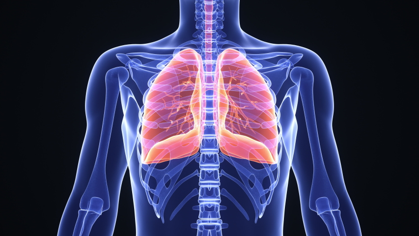 medical animation pneumonia other lung disease Stock Footage Video (100 ...