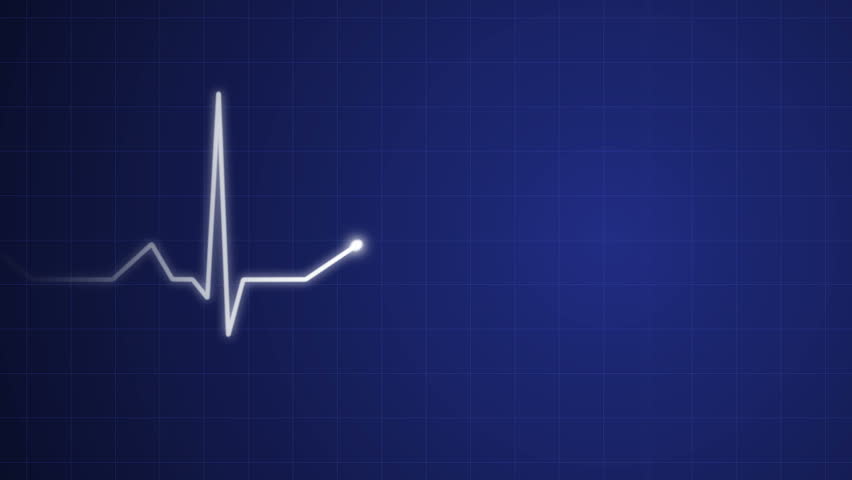 4k an Animated Heart Monitor Stock Footage Video (100% Royalty-free ...