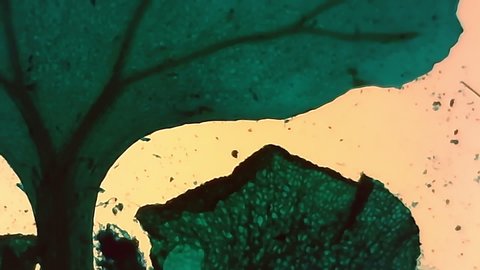 Microscope Fern Prothallia Sporangia Whole Mount Stock Footage Video ...