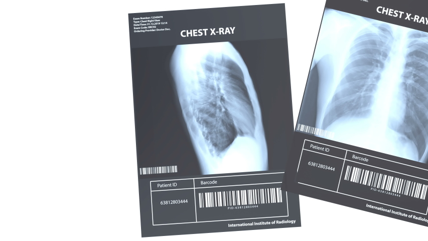x-rayqrbarcodes fake doctor exam two x-rays Stock Footage Video (100% ...