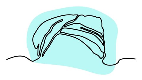 Types Fistulas Rectum Paraproctitis Anus Abscess Stock Vector (Royalty ...