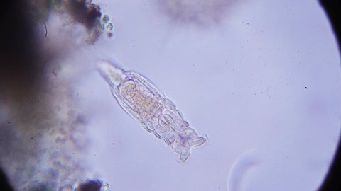 Microscopic Shrimp Under Microscope Stock Footage Video (100% Royalty ...