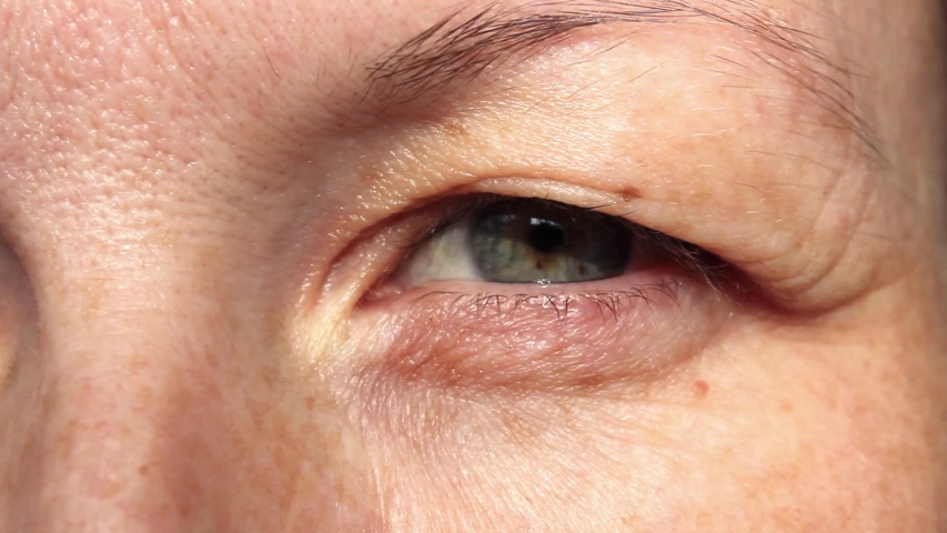 woman's gray eye lines around looks Stock Footage Video (100% Royalty ...