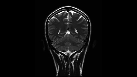 Series Animated Scans Computerized Tomography Brain Stock Footage Video ...