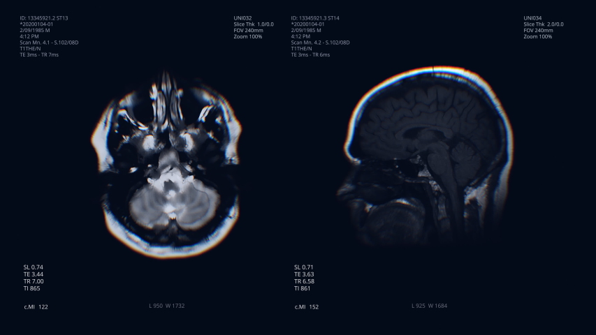 Brain scan visualization footage. The device scans and displays vital signs on the screen ...