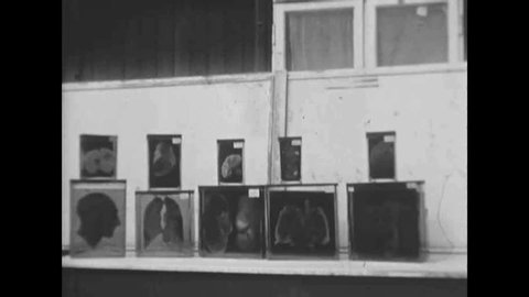 Circa 1945 Dachau Medical Experiments Seen Stock Footage Video (100% ...
