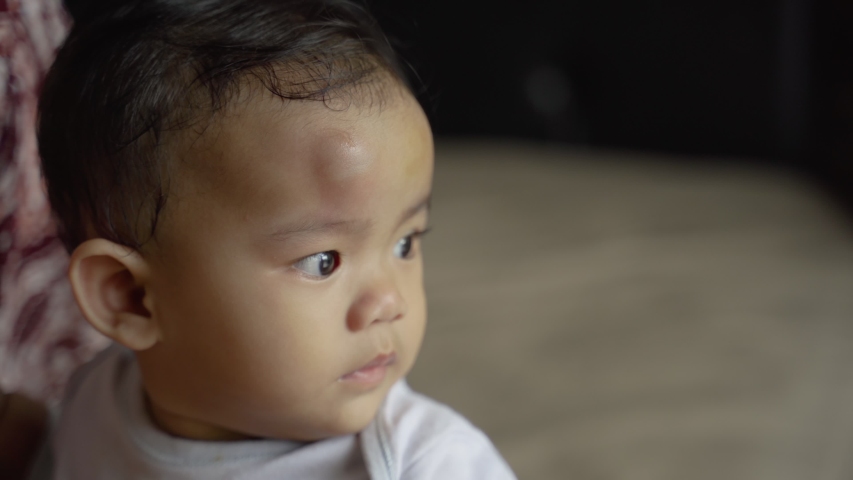 Bruise On Forehead Stock Video Footage - 4K and HD Video Clips ...