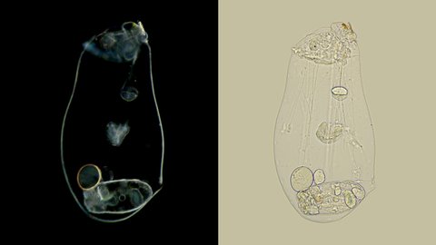 Rotifer Under Microscope Asplanchna Priodonta Family Stock Footage ...