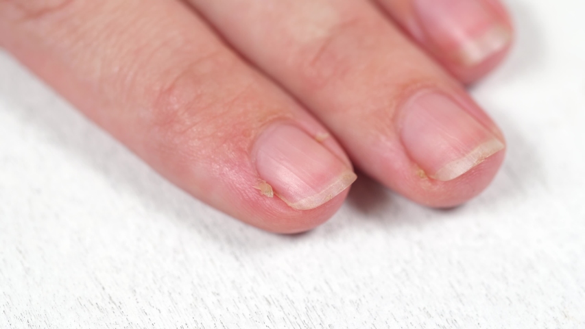Fragile Nails Stock Video Footage - 4K and HD Video Clips | Shutterstock