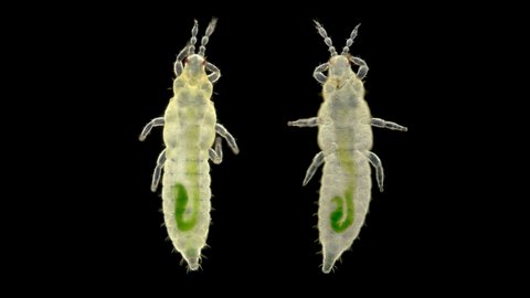 Collembola Insect Under Microscope Order Poduromorpha Stock Footage ...