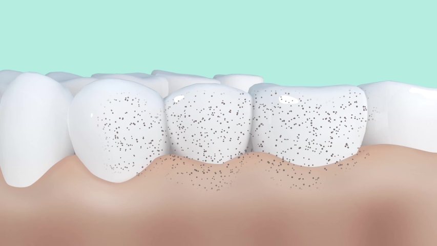 show removal dirt teeth3d Stock Footage Video (100% Royalty-free ...