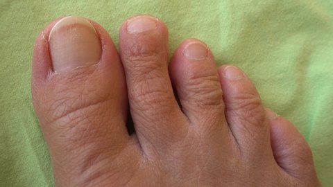 4k Unpainted Nails On Female Toes Stock Footage Video (100% Royalty ...