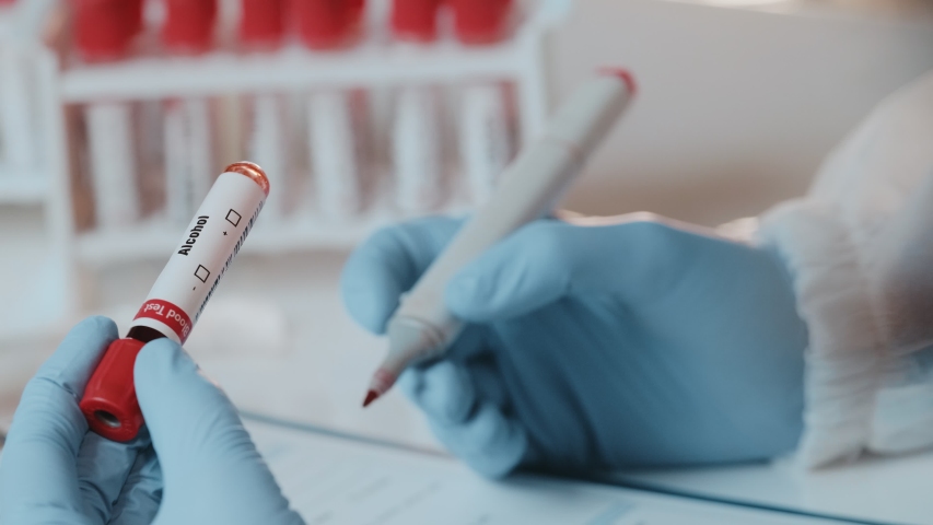 Drug And Alcohol Testing Stock Video Footage - 4K and HD Video Clips ...