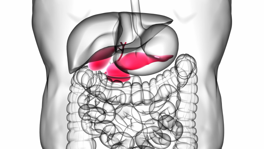 Gall Bladder Surgery Stock Video Footage - 4K and HD Video Clips ...