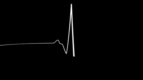 Moving Heartbeat Line