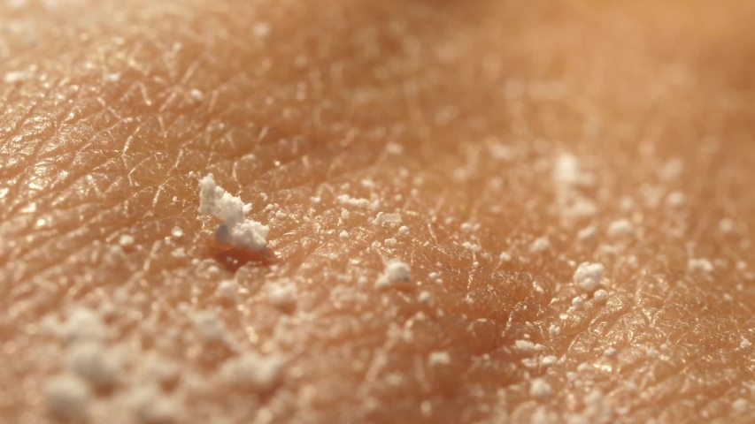 accumulation plastic particles on human skin: vídeo stock (100% livre ...