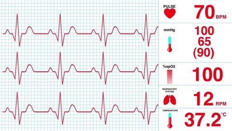 Heart Rate Graphics Vector Illustration Electrocardiogram Stock Vector ...
