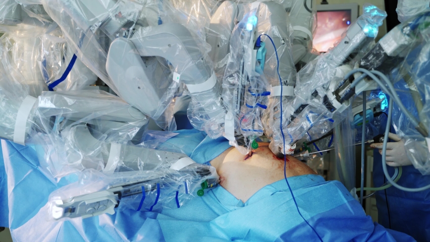 futuristic surgery robotic arms modern medical Stock Footage Video (100 ...