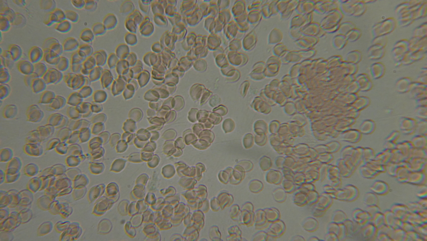 human blood diseases interstitial fluid bacterial Stock Footage Video ...