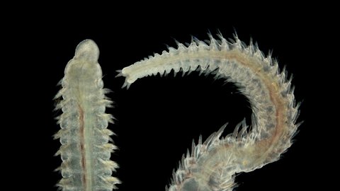 Worm Polychaeta Naineris Sp Under Microscope Stock Footage Video (100% ...